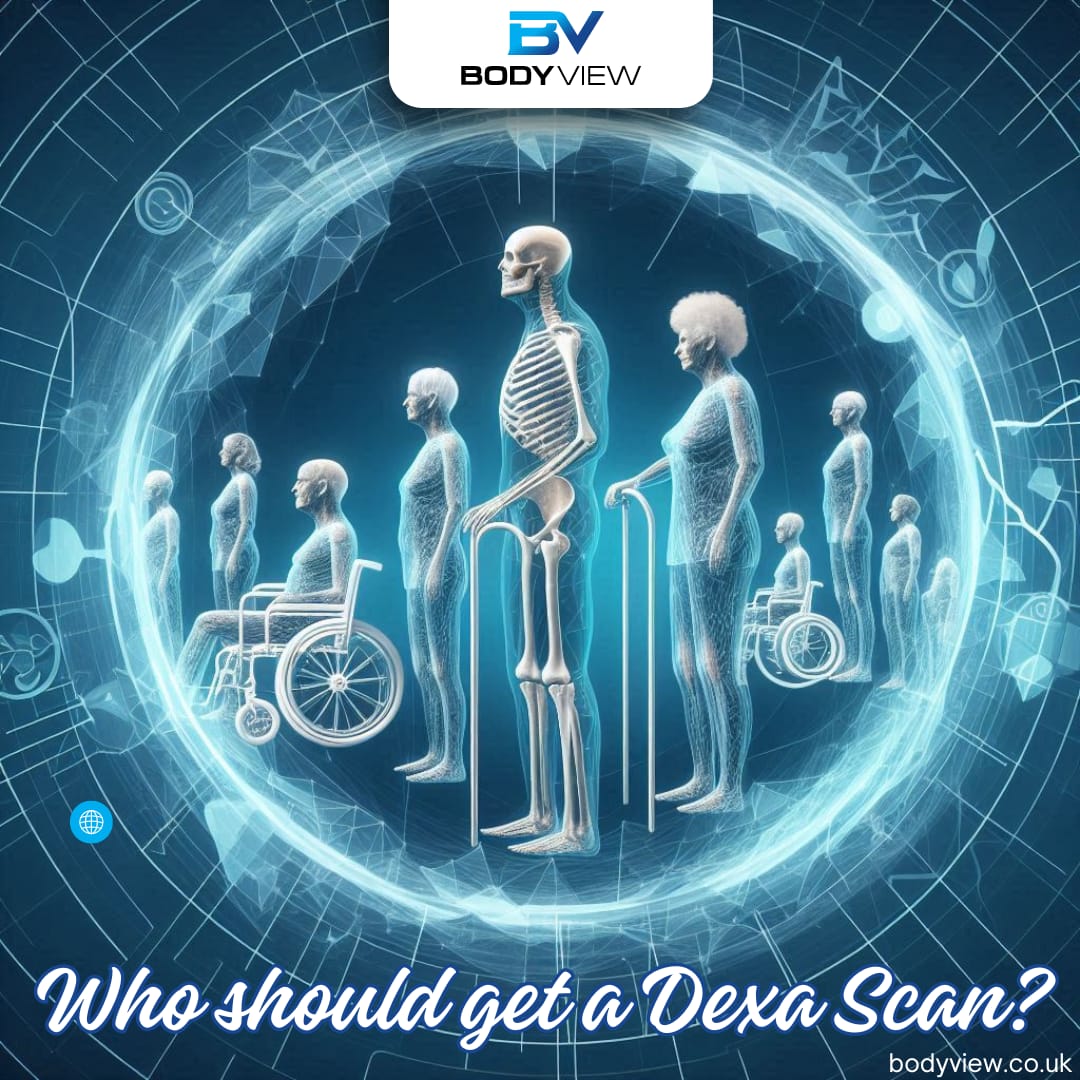 Understanding DEXA Bone Scans: The Gold Standard for Body Composition ...