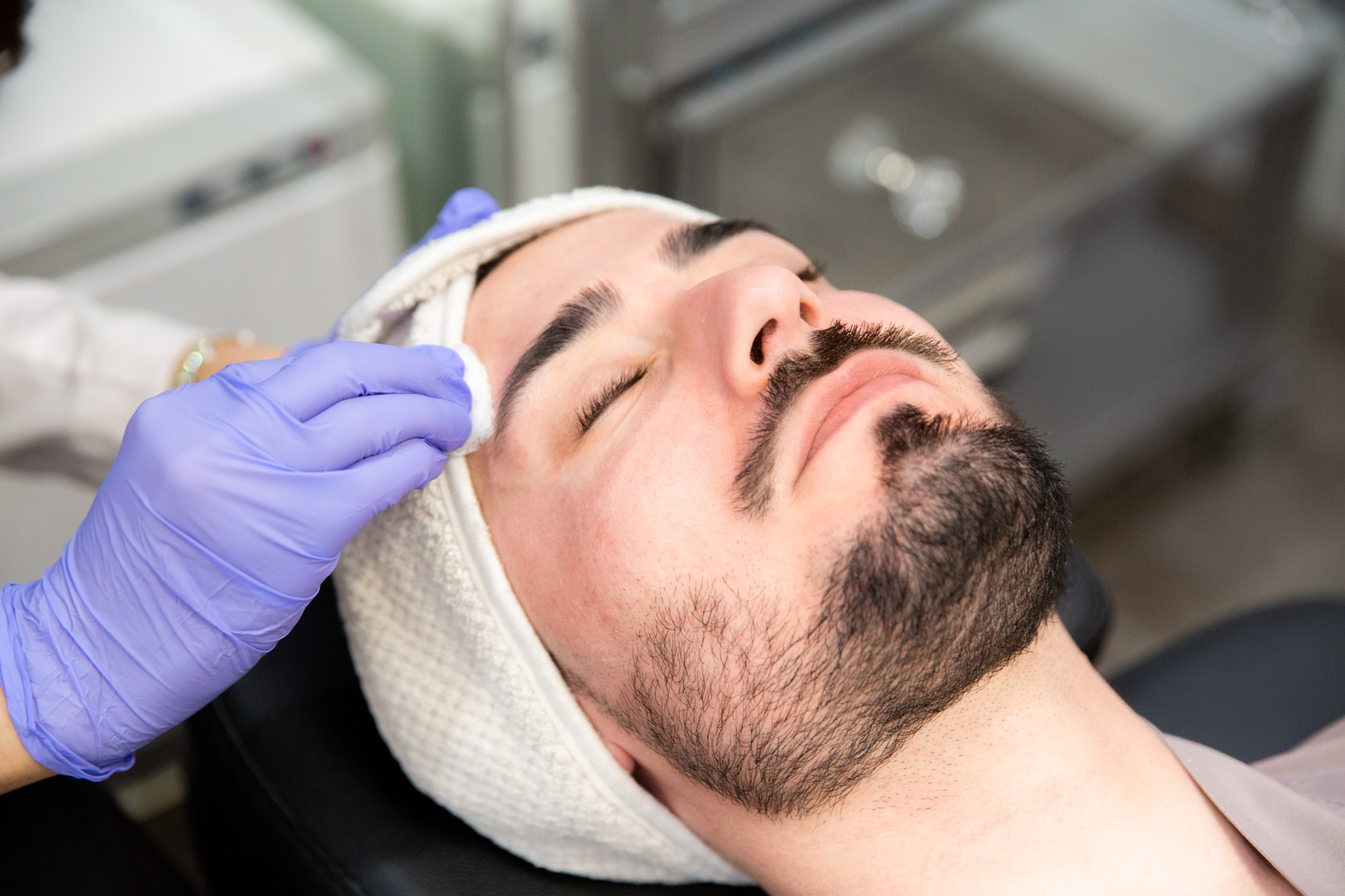 How to Buy TCA Peel: A Step-by-Step Guide - Picnob